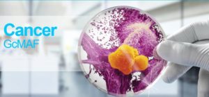 GcMAF: Another Suppressed Cancer Treatment? - Natural Society